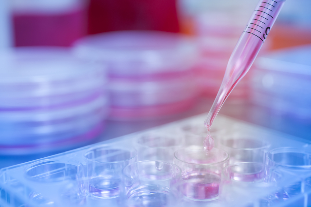 Breast Cancer Treatment: The TAILORx Clinical Trial – After 20 Years